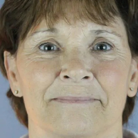 Top Facial Surgeon Kansas City | Vargas Face & Skin Center