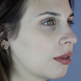 Old Scars: Treatment and Common Questions Answered | Vargas Face & Skin ...