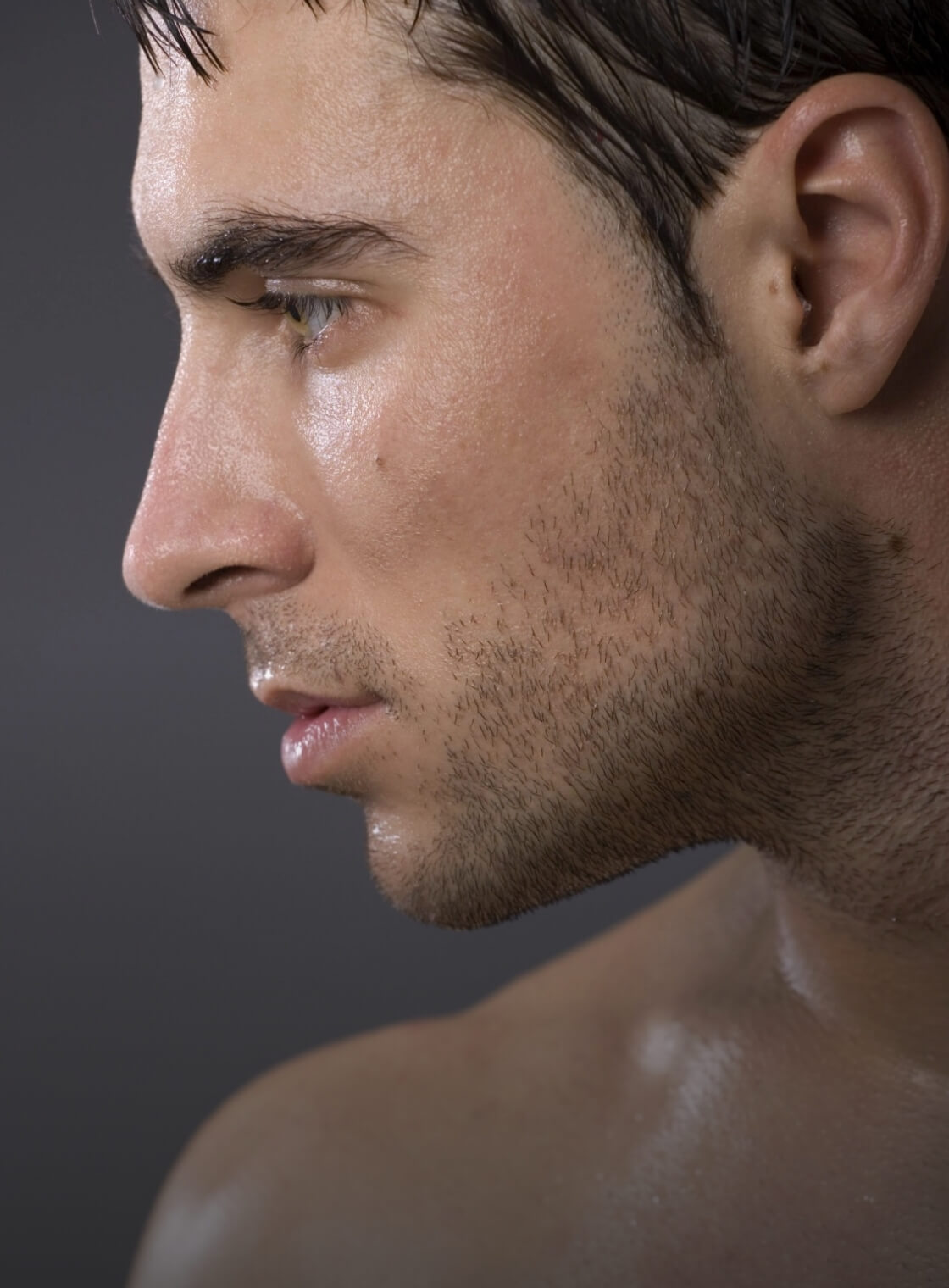 Types of Atrophic Scarring: How They Differ and How to Treat Them ...