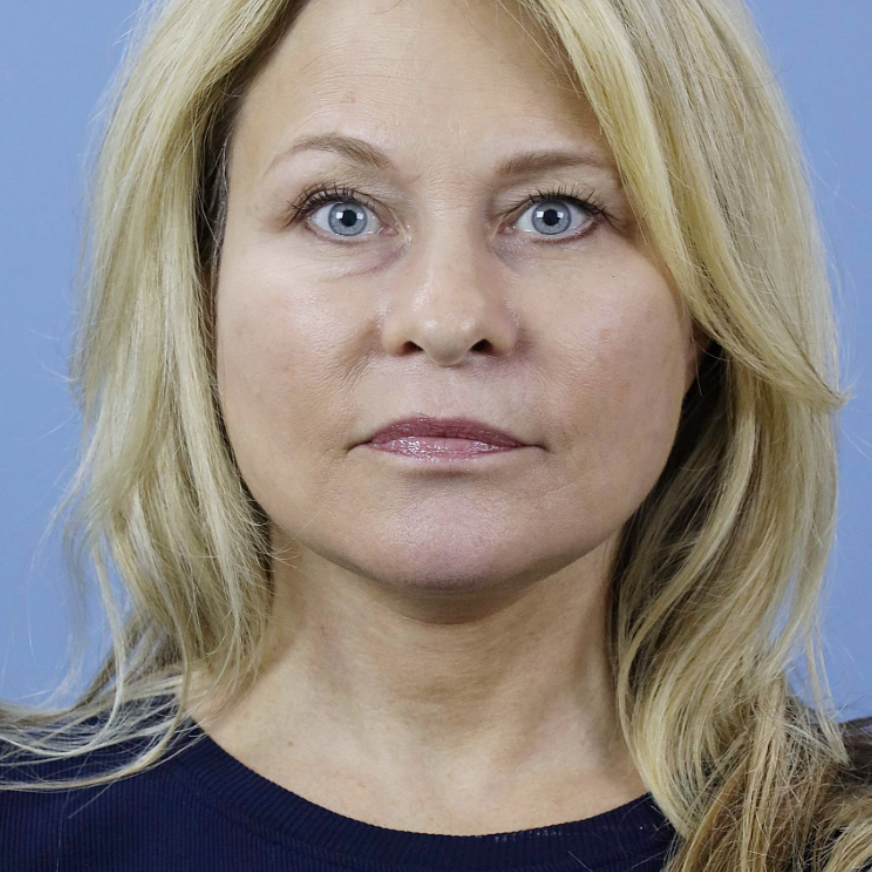 Unpacking Eye Bags: What Causes Them and How To Get Rid of Them ...